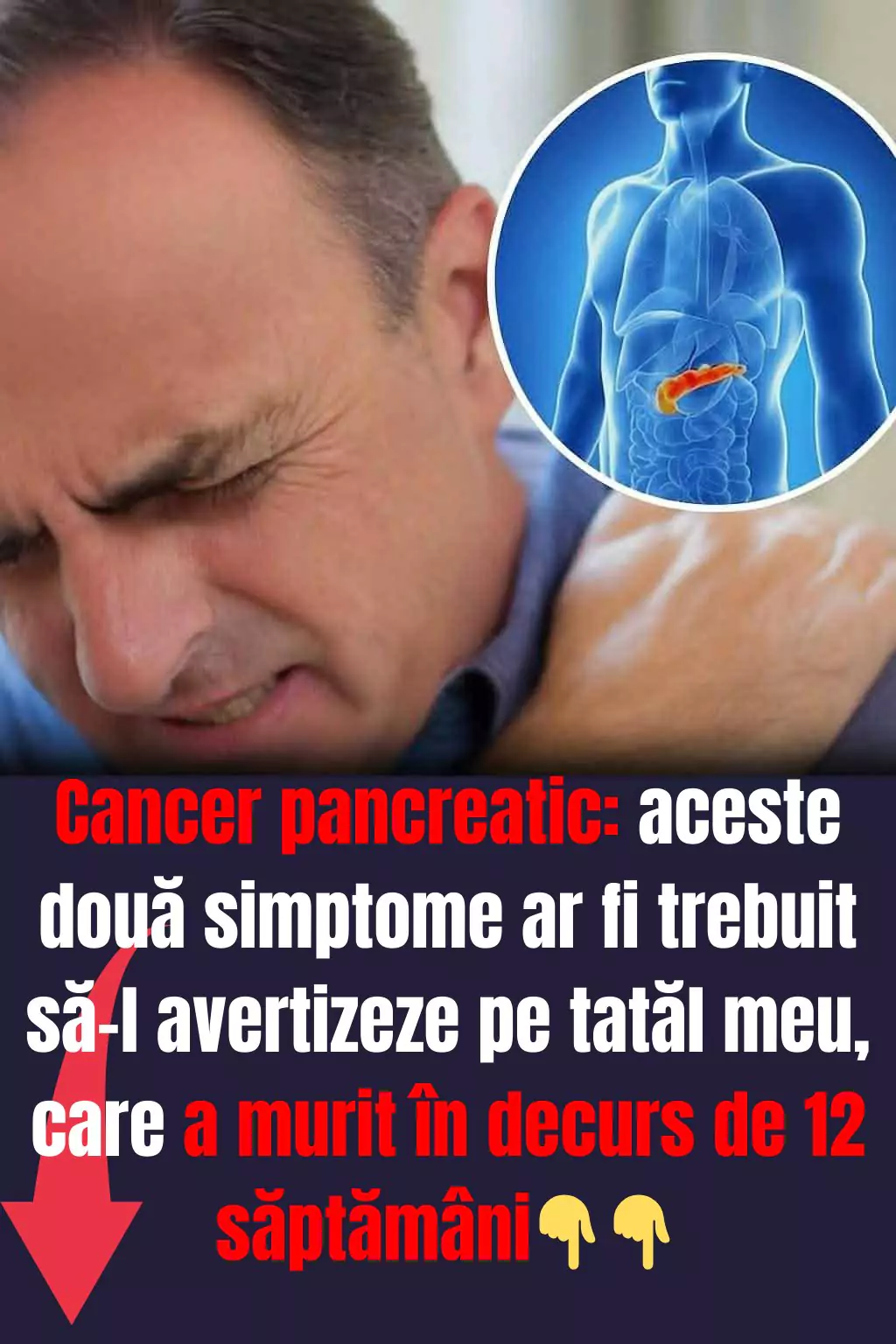 Cancerul pancreatic: 10 simptome timpurii pe care nu trebuie să le ...